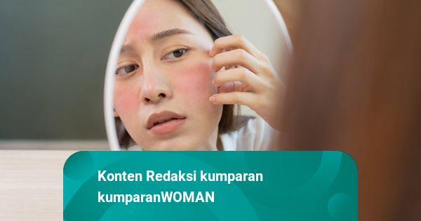 Bolehkah Kulit Sensitif Memakai Skin Care dengan Kandungan Retinol? | kumparan.com